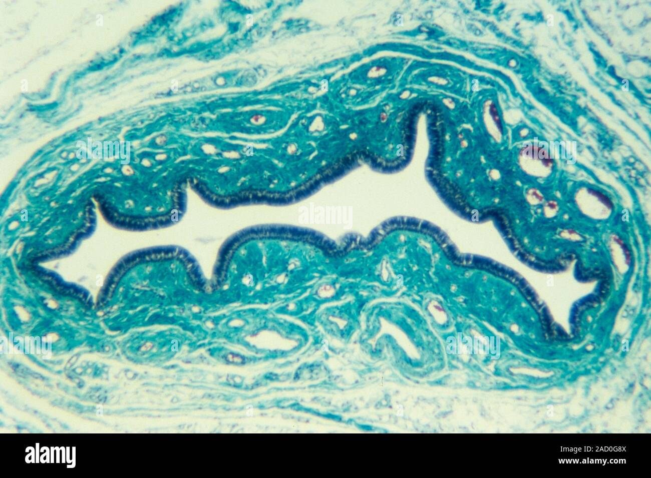 Light micrograph of a section through the excretory duct of a human ...