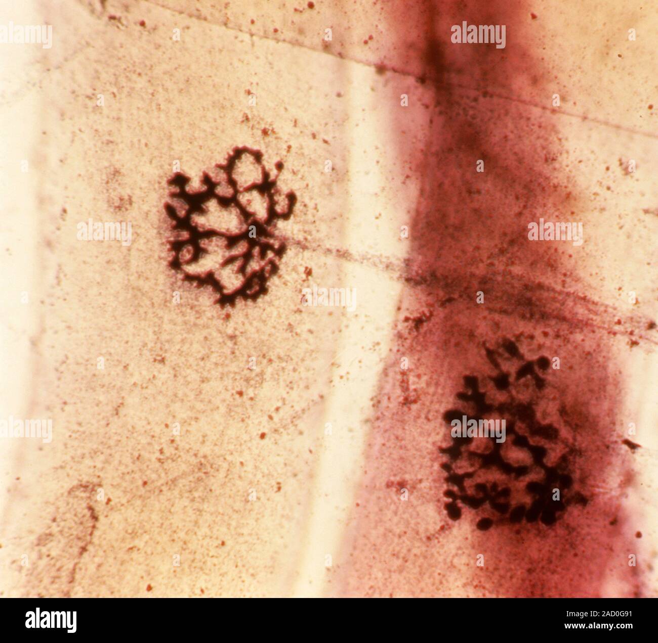 Neuromuscular junction. Light micrograph of two motor end plates, the ...
