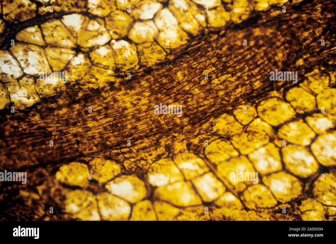 Artery in fat tissue. Light micrograph of an artery (centre) running ...