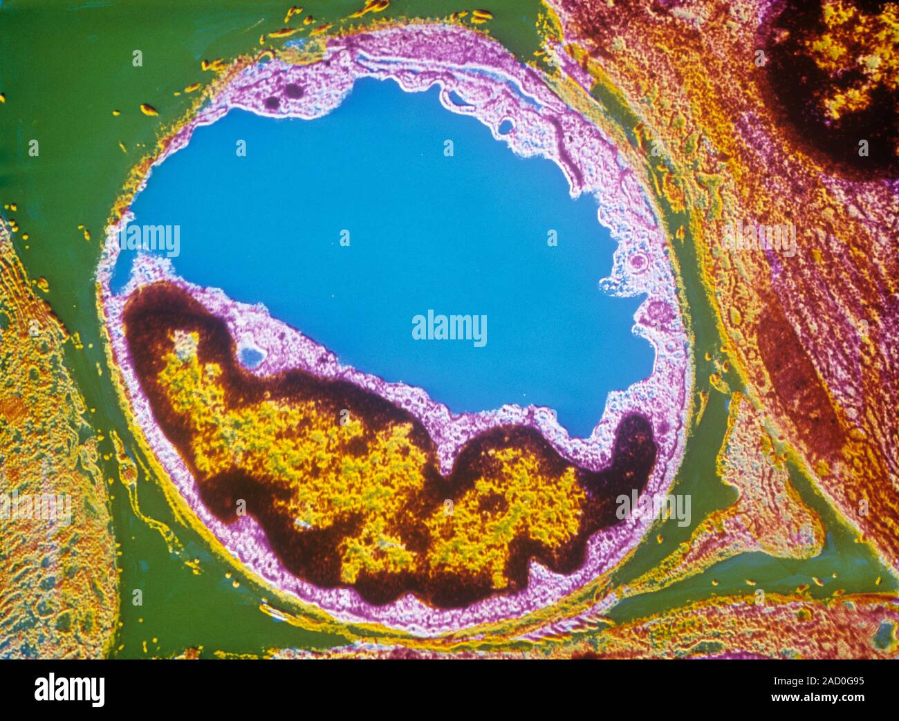 Blood capillary. Coloured transmission electron micrograph (TEM) of a ...