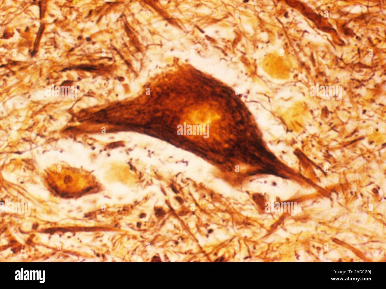 Light micrograph of nerve cell (neurone) from the human spinal cord ...