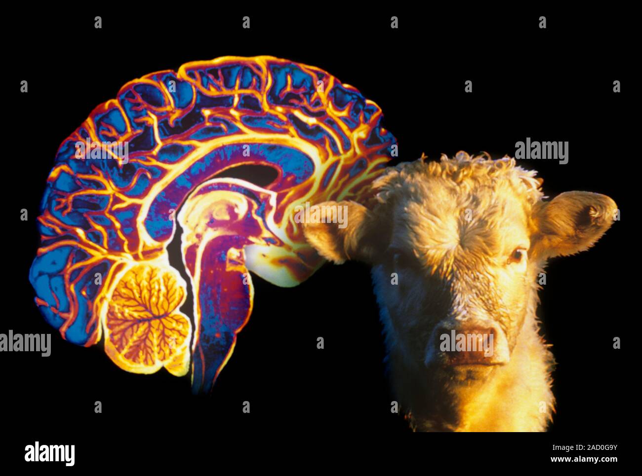 Illustration of the risk of Creutzfeldt-Jakob disease. Magnetic ...