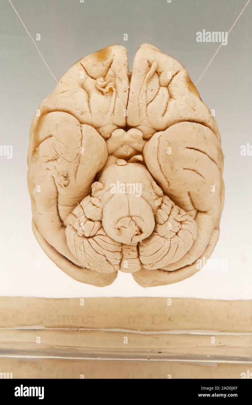 Macaque brain. Preserved brain of a bonnet macaque (Macaca radiata ...
