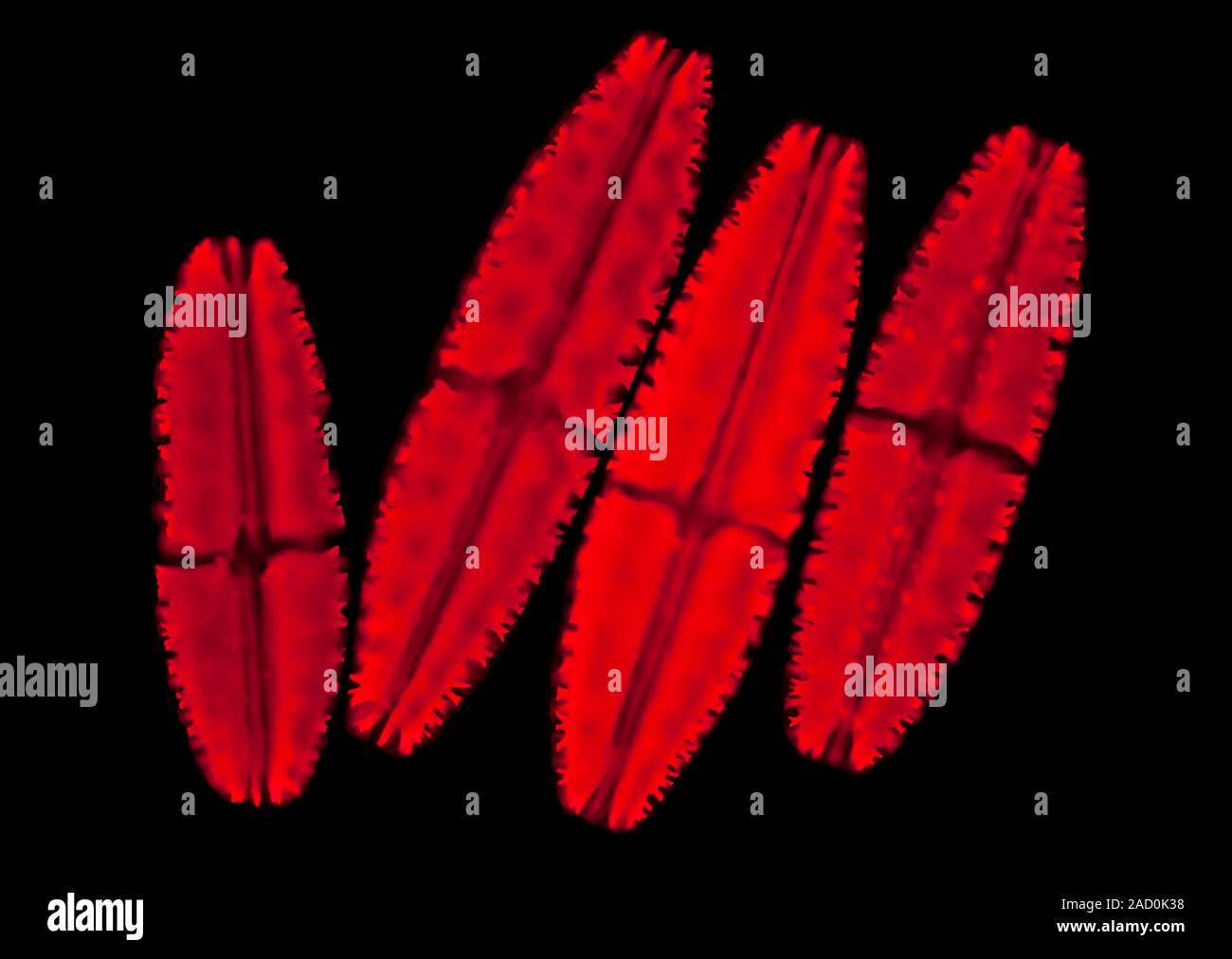Light micrograph of the desmid green alga Netrium digitus. Red auto ...
