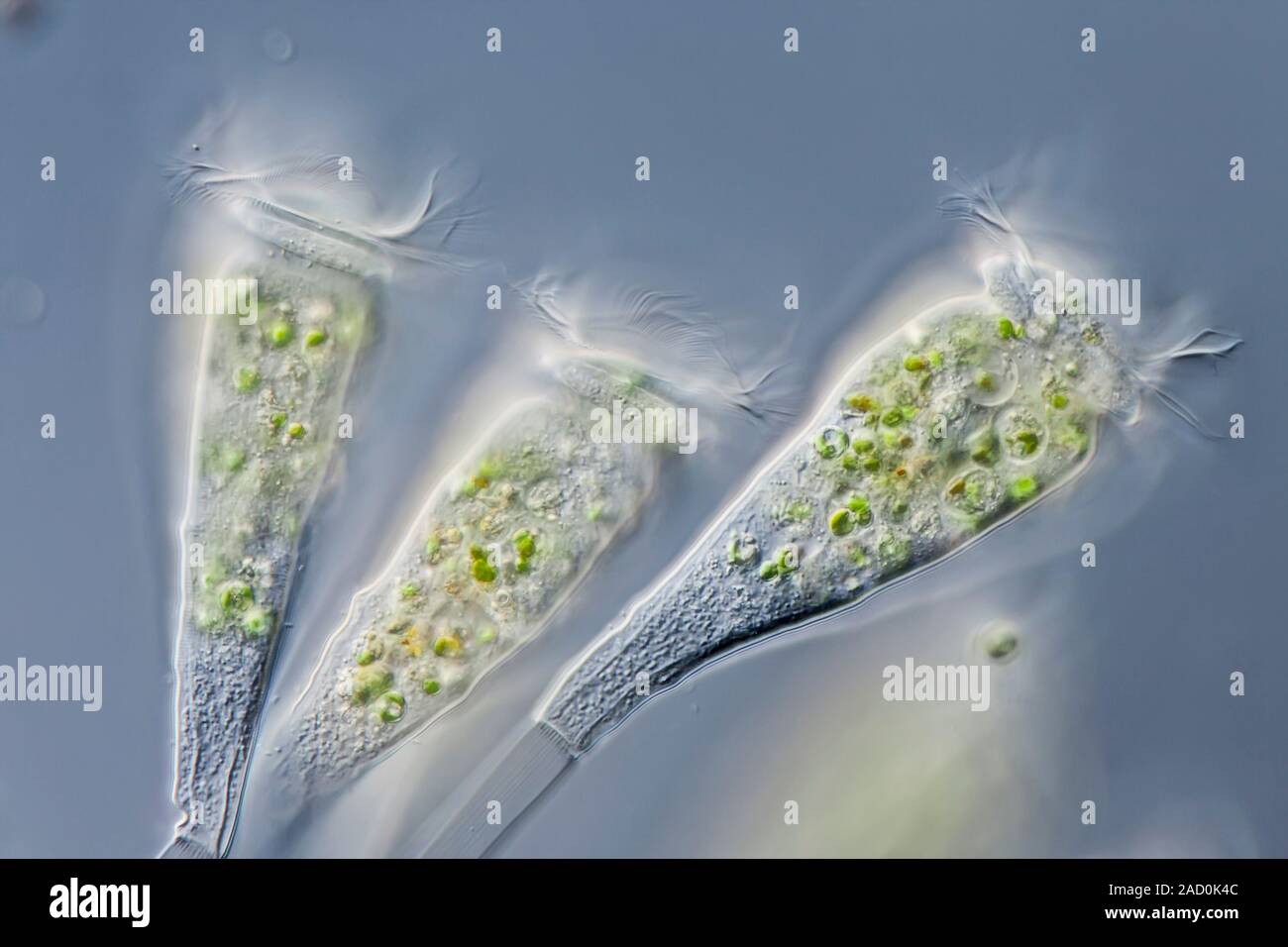 Epistylis sp. ciliates feeding. Crop of three individuals of a colony ...