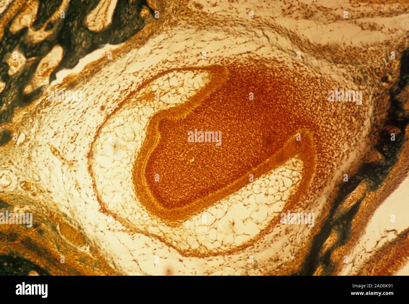 Tooth bud. Light micrograph of a section through a tooth bud from a ...