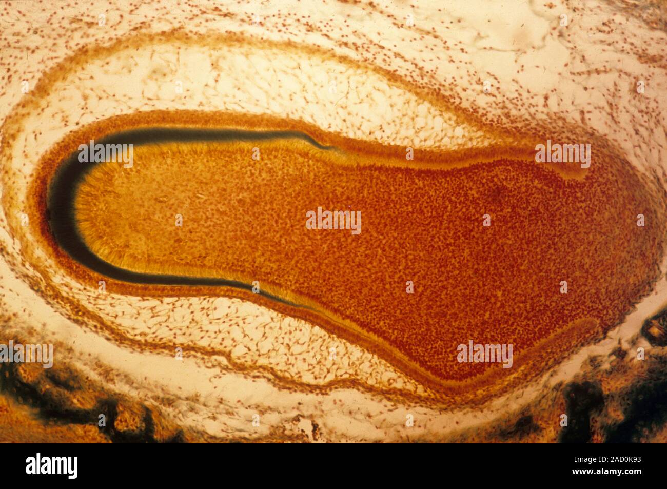 Tooth bud. Light micrograph of a section through a tooth bud from a ...