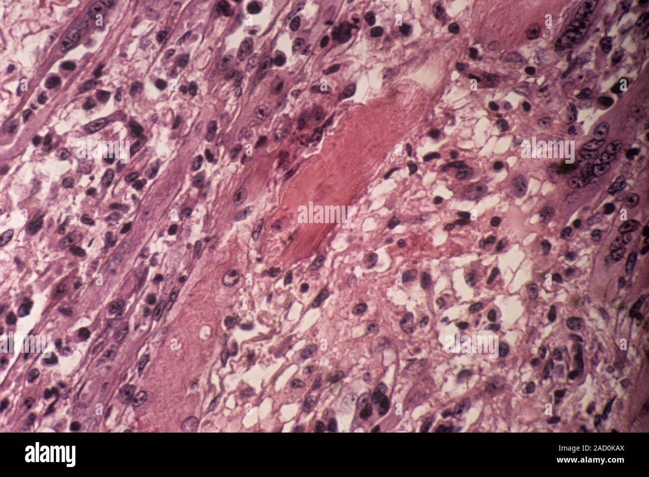 Damaged muscle tissue. Light micrograph of a section through a ...