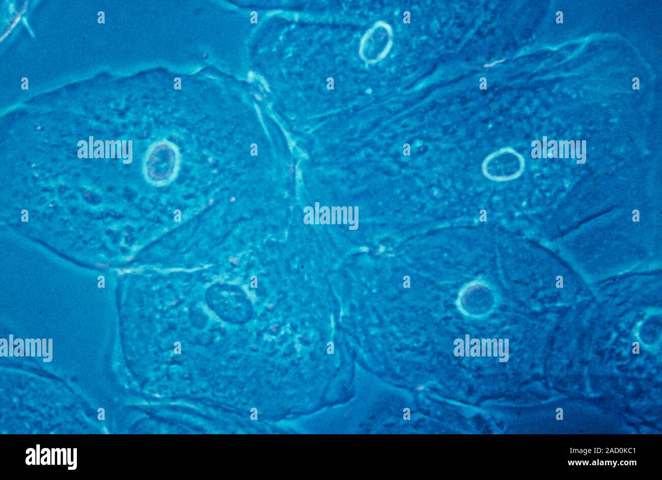 Cheek cells. Differential interference contrast micrograph of squamous ...