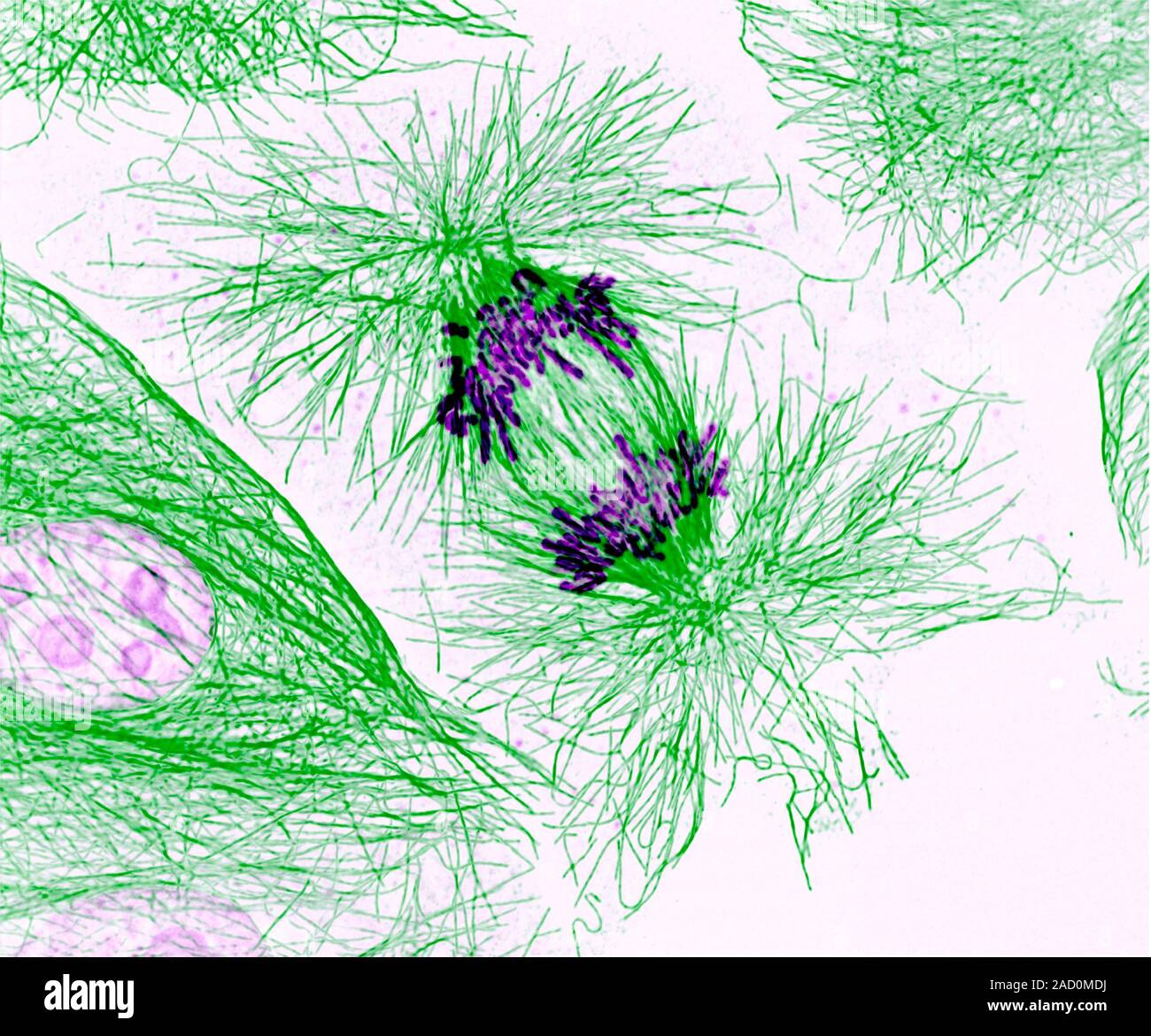 Dividing cell. Light micrograph of a section through pig cells showing ...