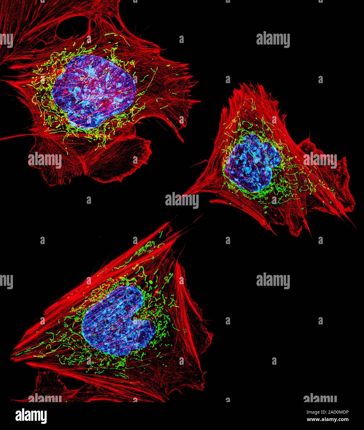 Fibroblasts. Micrograph of a section through fibroblast cells, showing ...