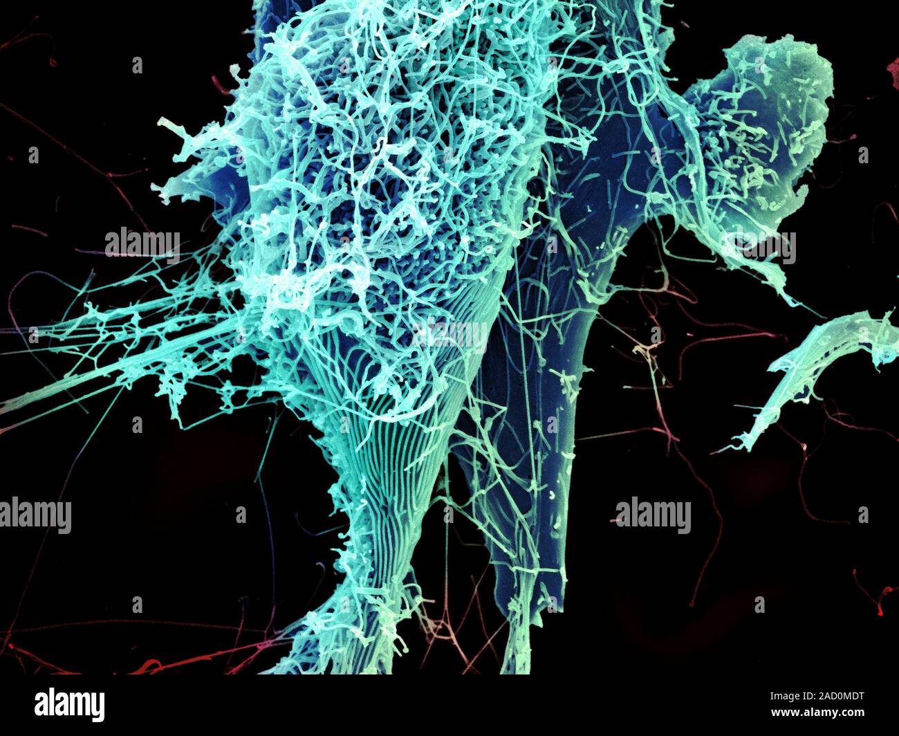 Ebola virus particle. Coloured scanning electron micrograph (SEM) of an ...
