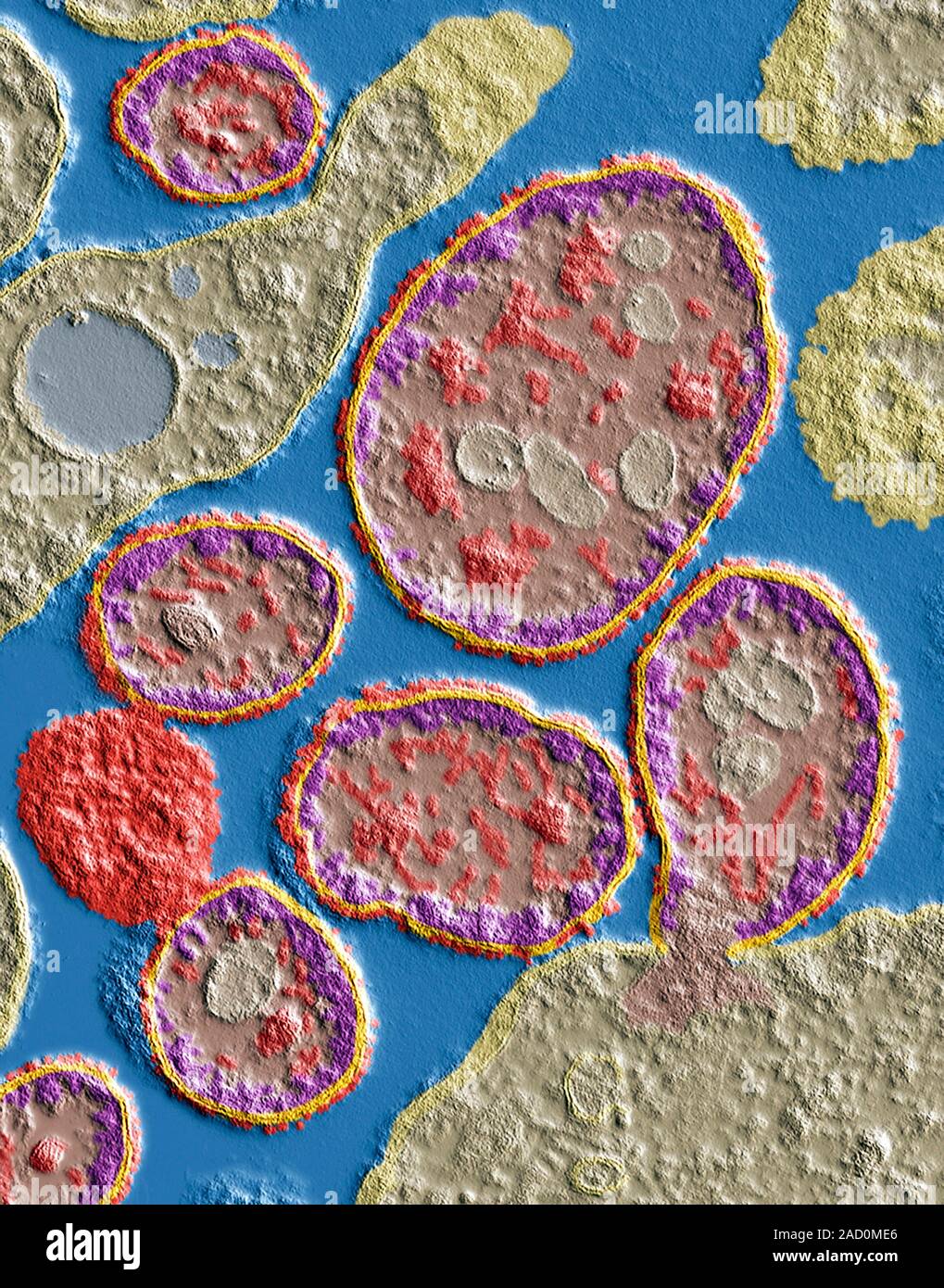 Measles virus infection. Coloured transmission electron micrograph (TEM ... Measles virus infection. Coloured transmission electron micrograph (TEM ...