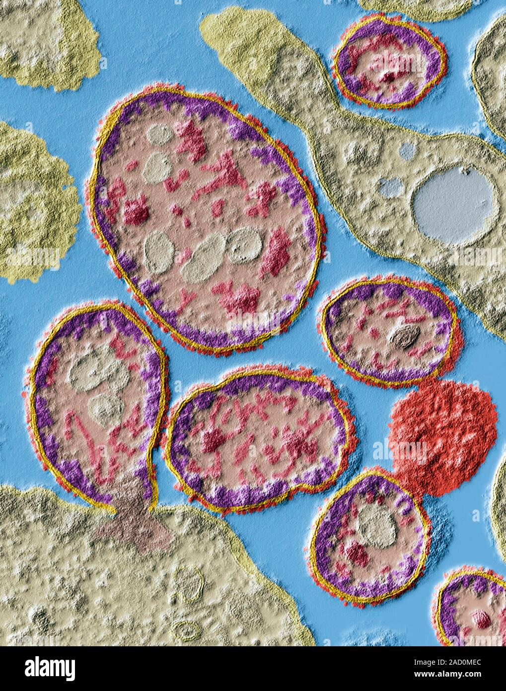 Measles virus infection. Coloured transmission electron micrograph (TEM ... Measles virus infection. Coloured transmission electron micrograph (TEM ...