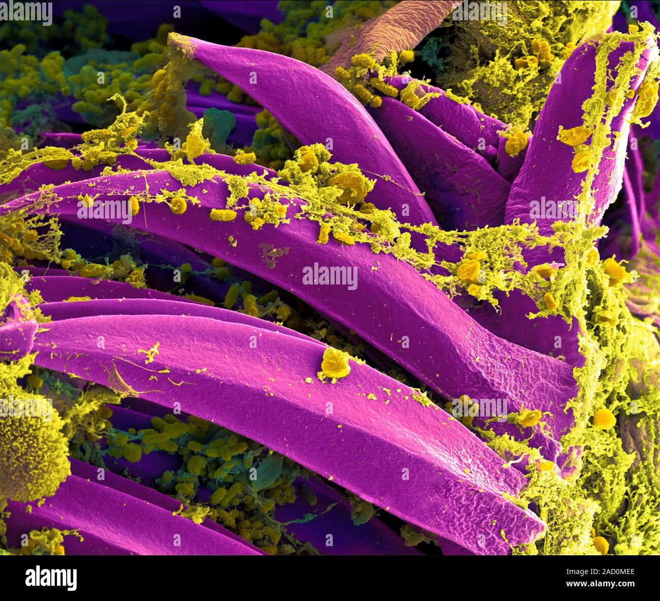 Yersinia pestis bacteria. Coloured scanning electron micrograph of ...