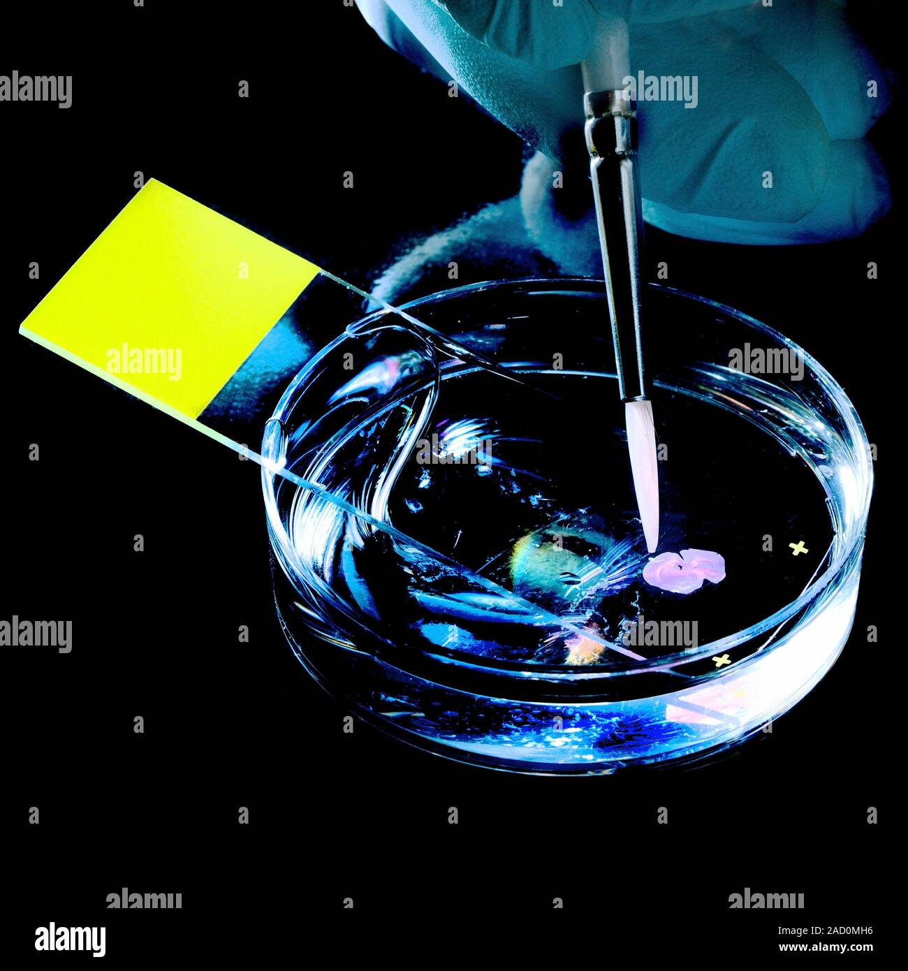 Brain slices, tau protein analysis. Close-up of slices of mouse brains ...