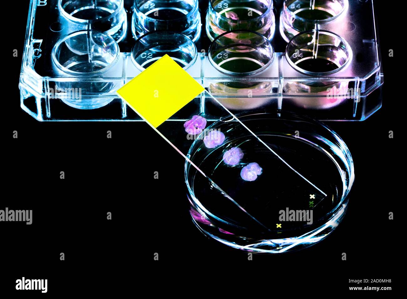 Brain slices, tau protein analysis. Slices of mouse brains that have ...