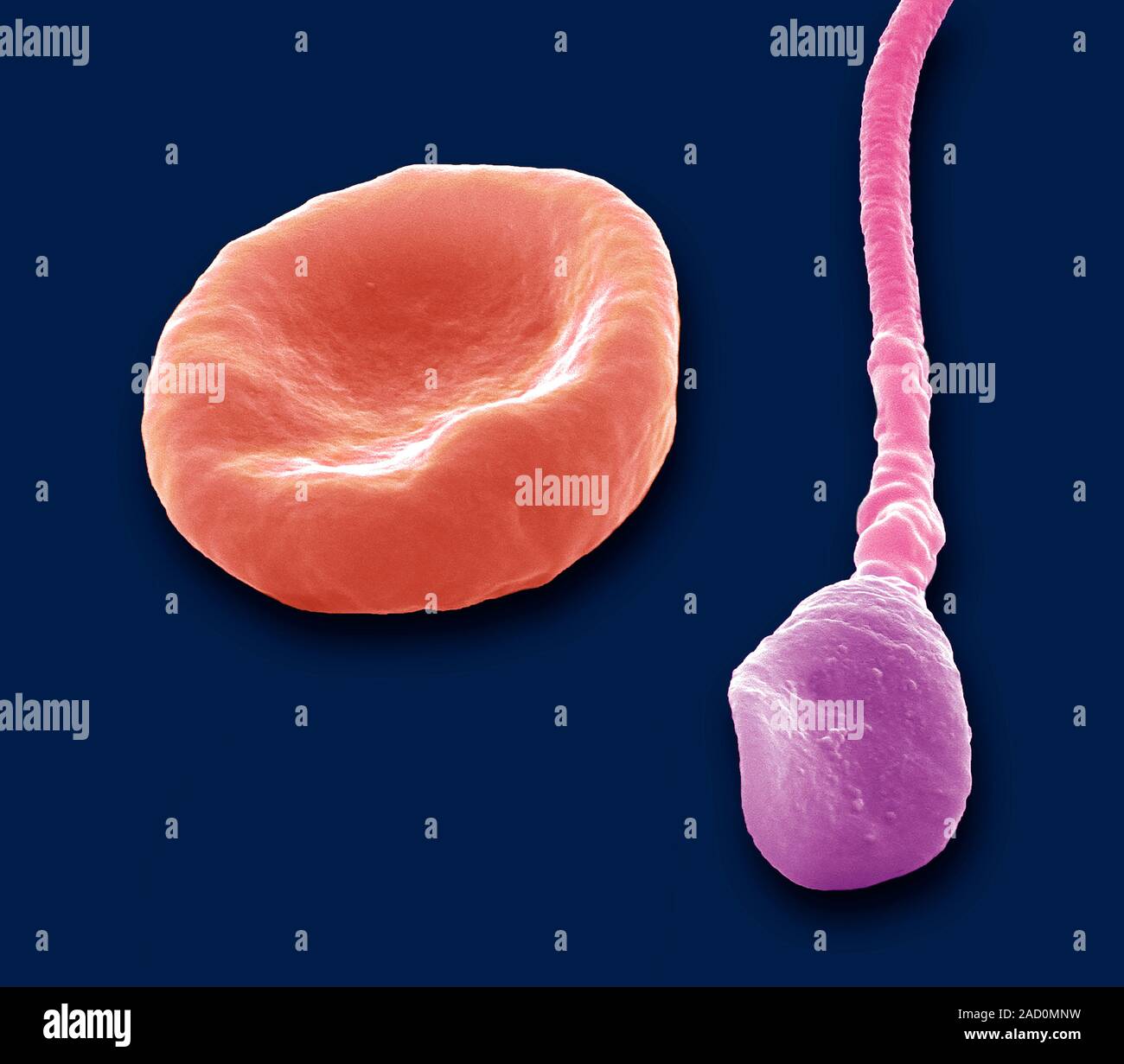 Red blood cell and spem. Coloured scanning electron micrograph (SEM ...