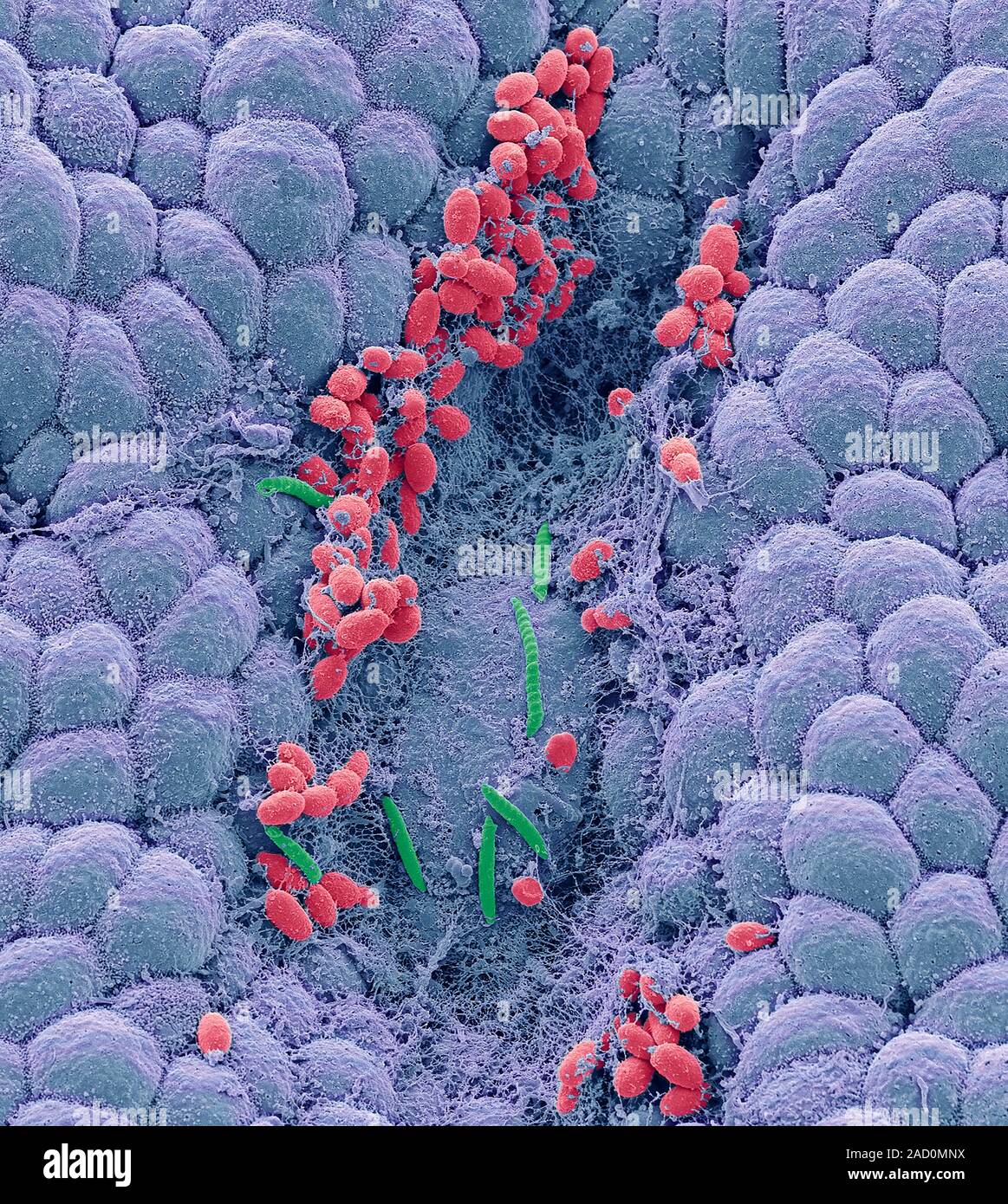 Helicobacter pylori bacteria and yeast in the stomach. Coloured ...