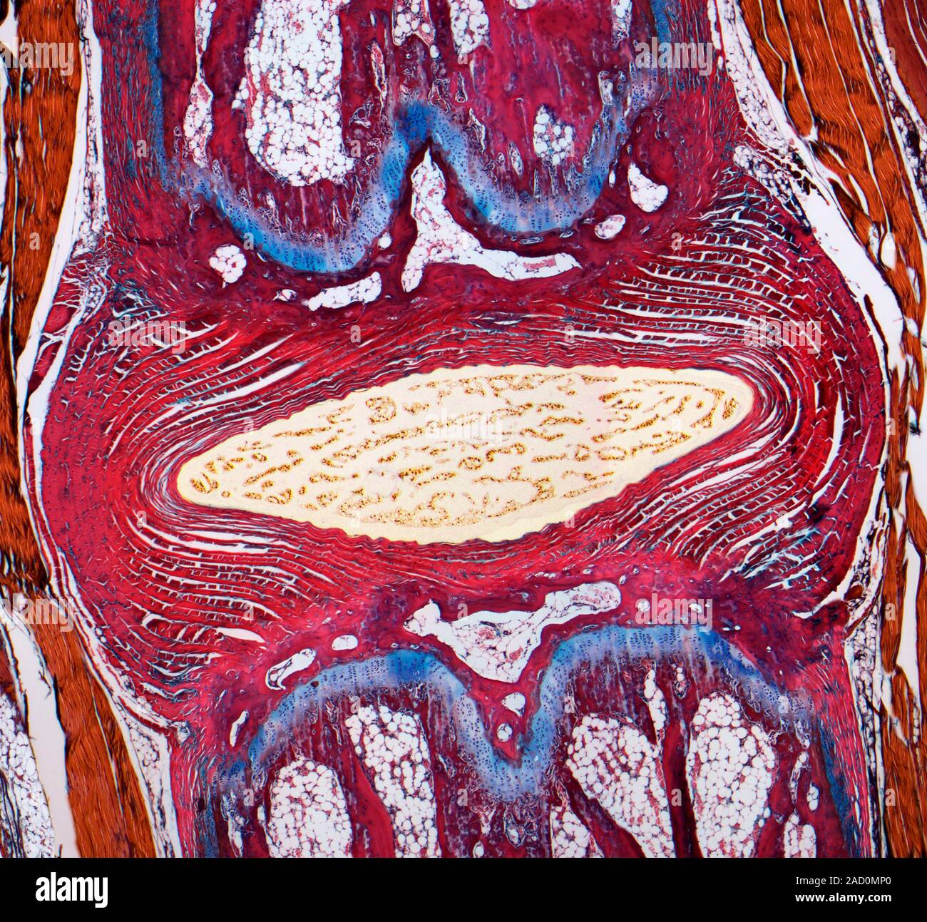 Intervertebral disc. Light micrograph of a vertical section through an ...