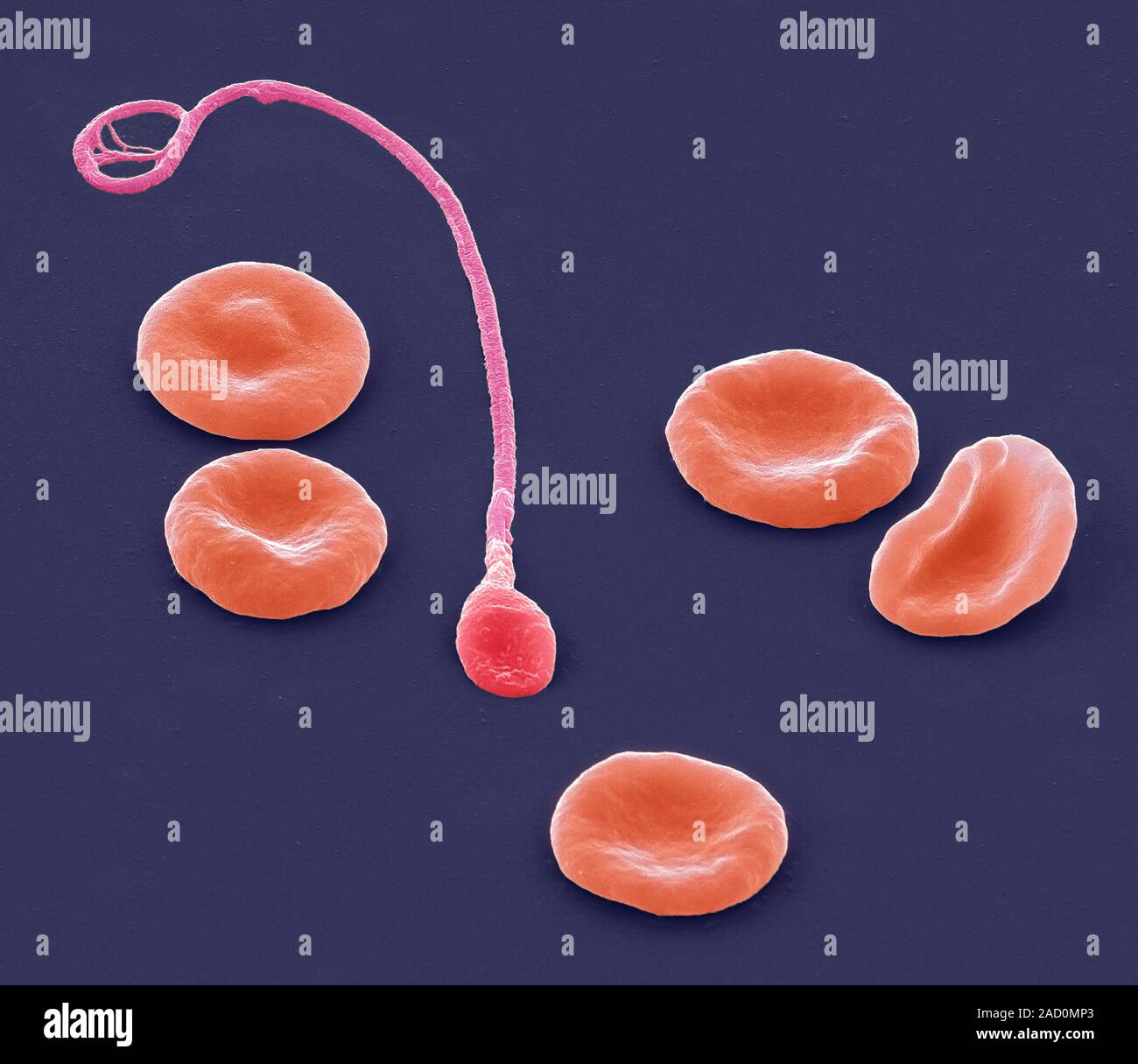 Red blood cells and spem. Coloured scanning electron micrograph (SEM ...