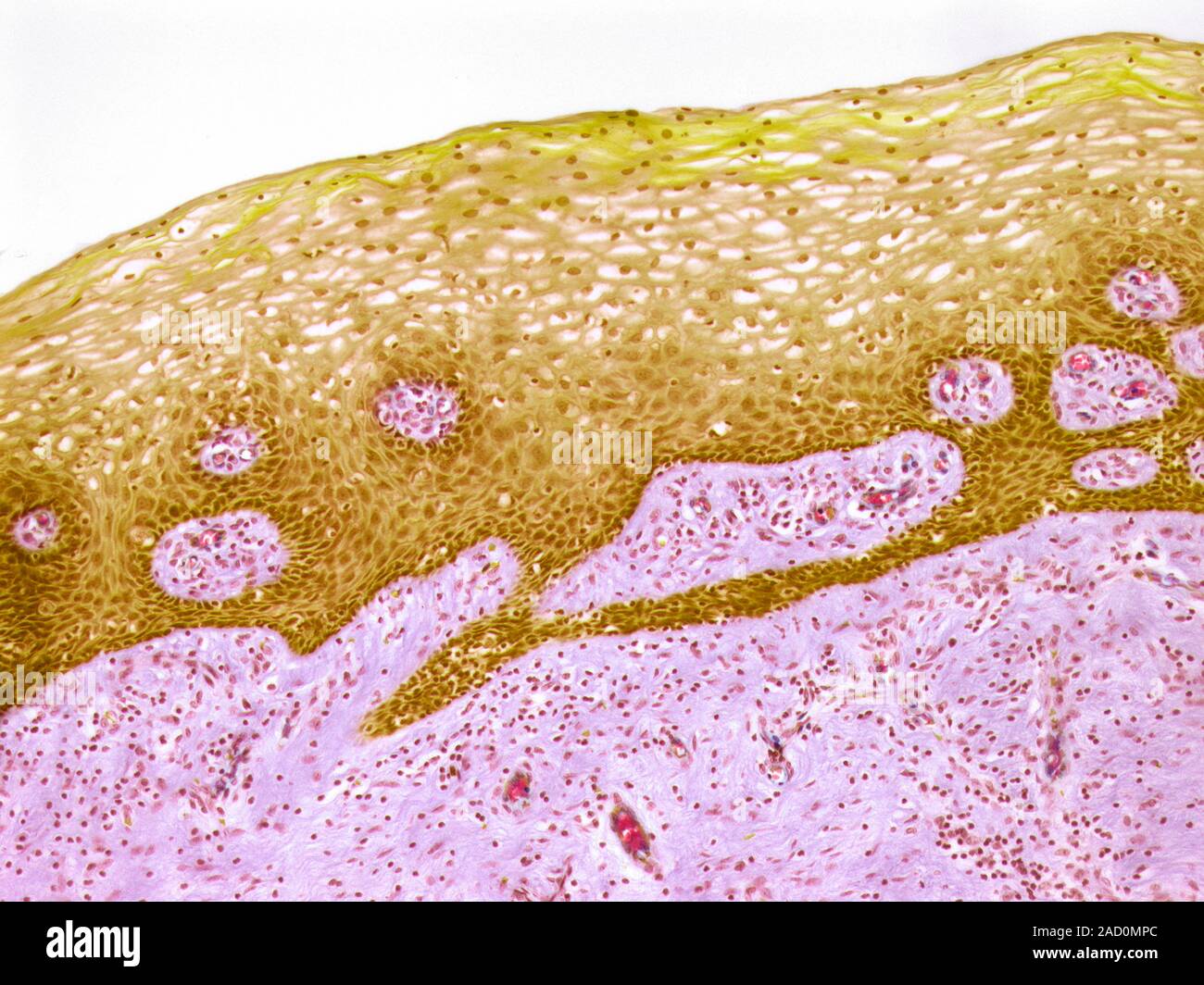 Human cervix. Light micrograph of a section through the epithelium of a ...