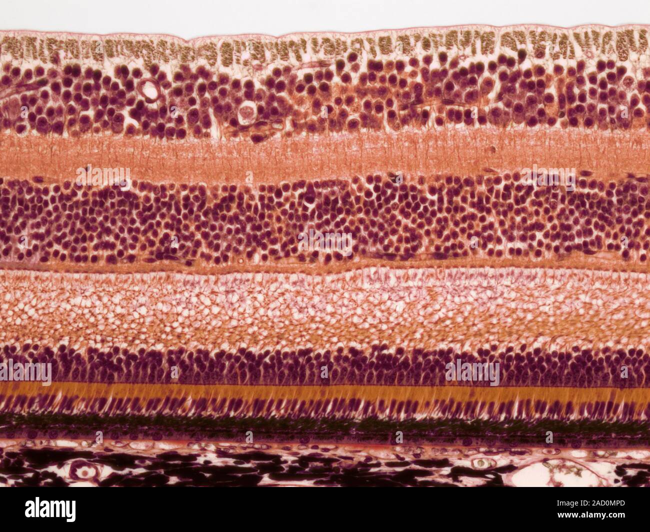 Retina. Light micrograph of a section through a retina. The eye works ...