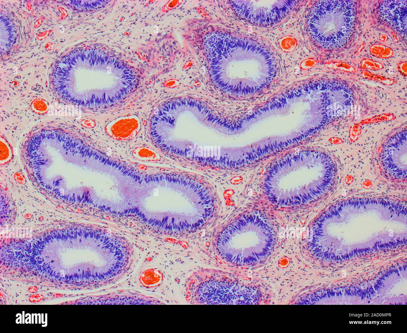 Human epididymis. Light micrograph of a section through a human ...