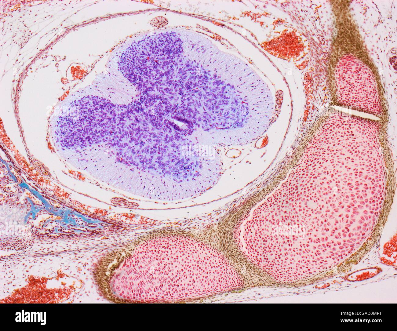 Vertebra and spinal cord development, Light micrograph of a sction of a ...
