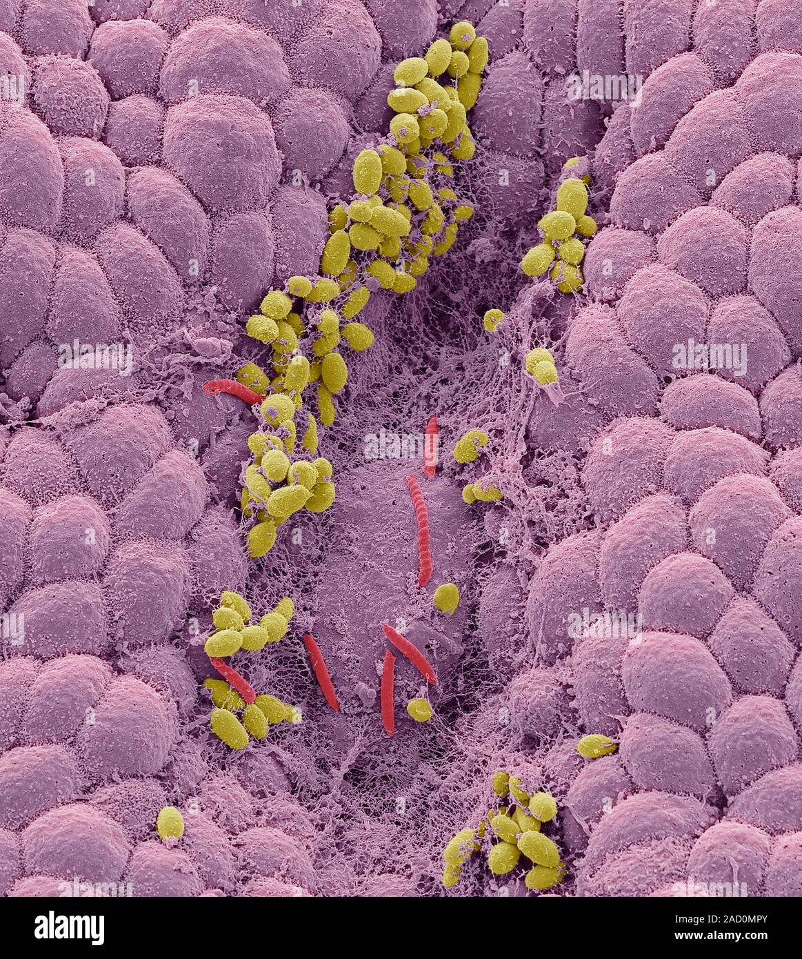 Helicobacter pylori bacteria and yeast in the stomach. Coloured ...