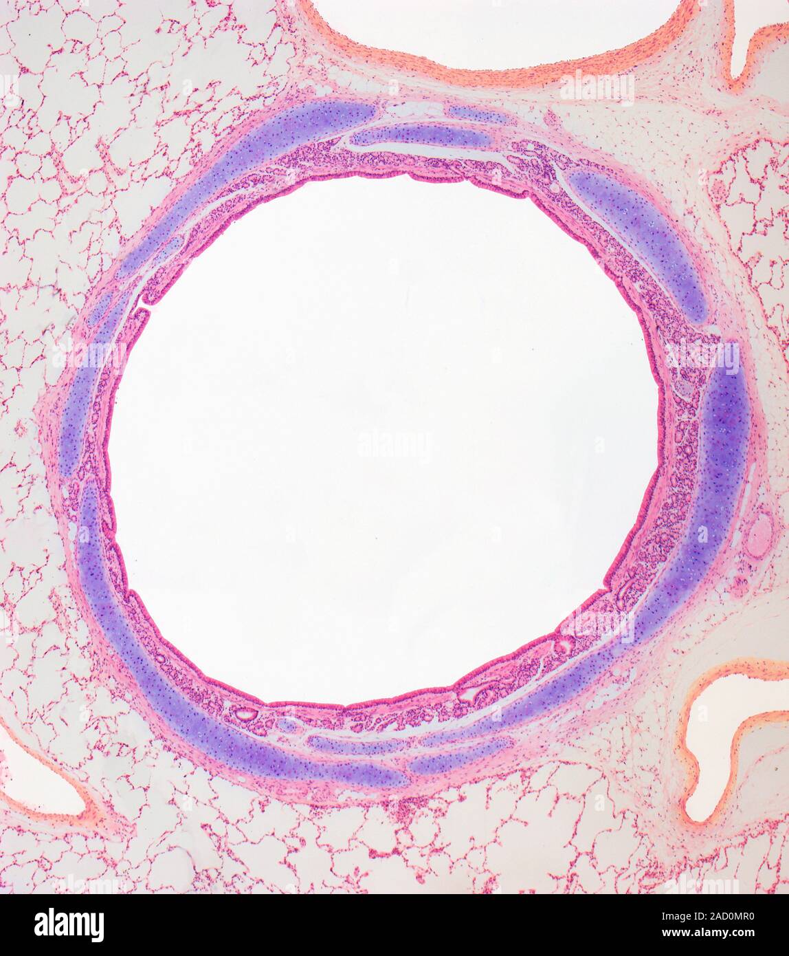 Lung bronchus. Light micrograph of a section through lung tissue and a ...