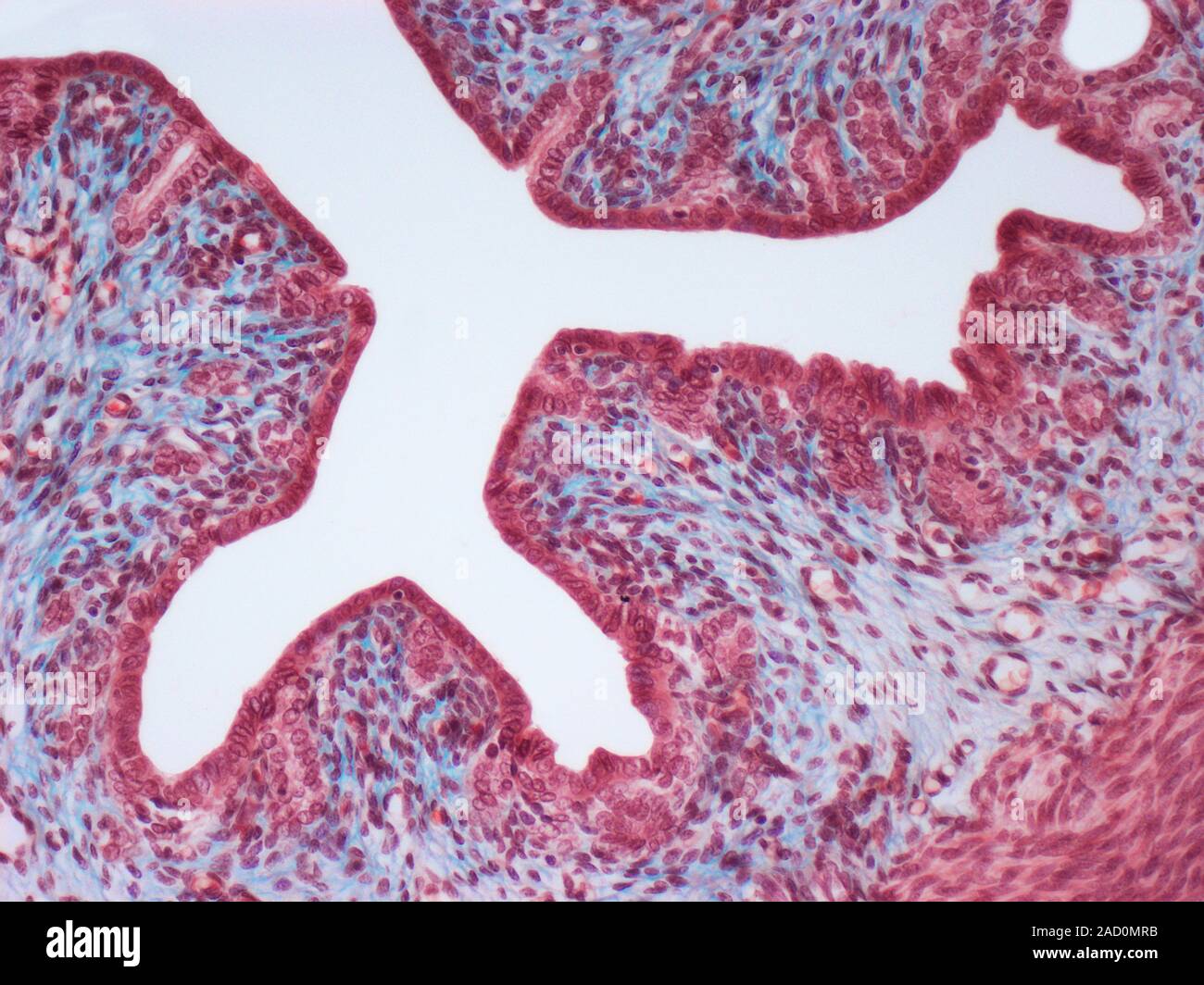 Uterus. Light micrograph of a section through the wall of the uterus ...