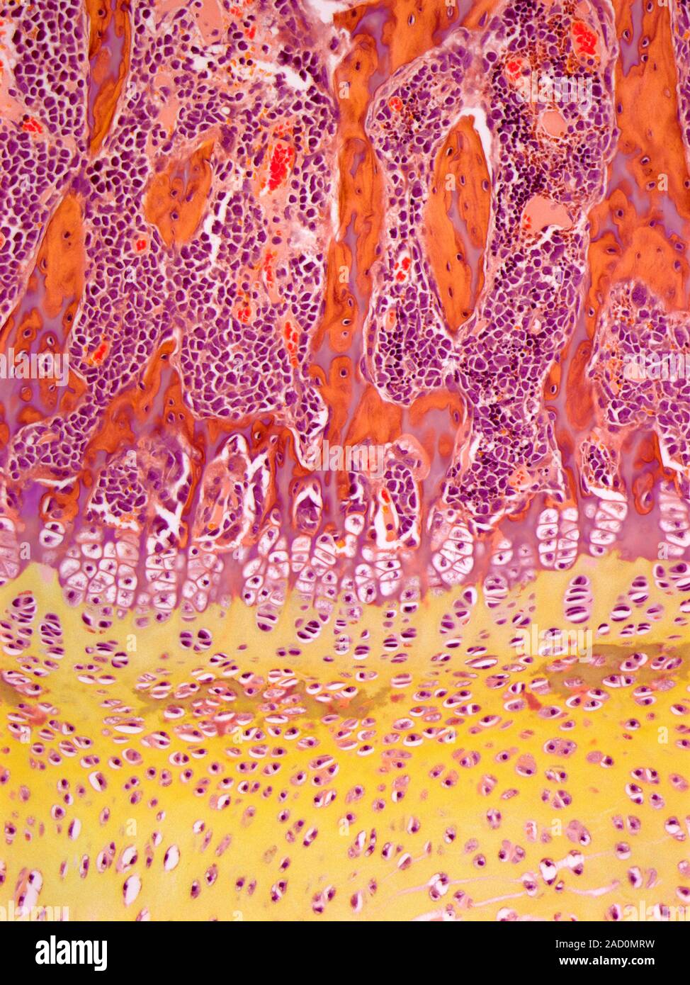 Bone growth, light micrograph from a section of vertebral column ...
