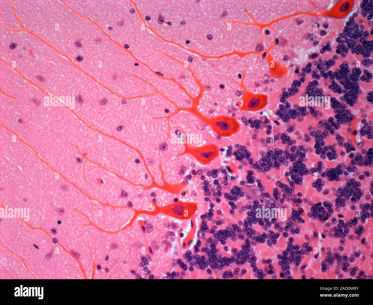Purkinje nerve cells. Light micrograph of a row of Purkinje nerve cells ...