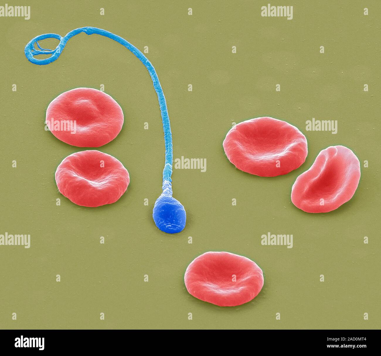 Red blood cells and spem. Coloured scanning electron micrograph (SEM ...