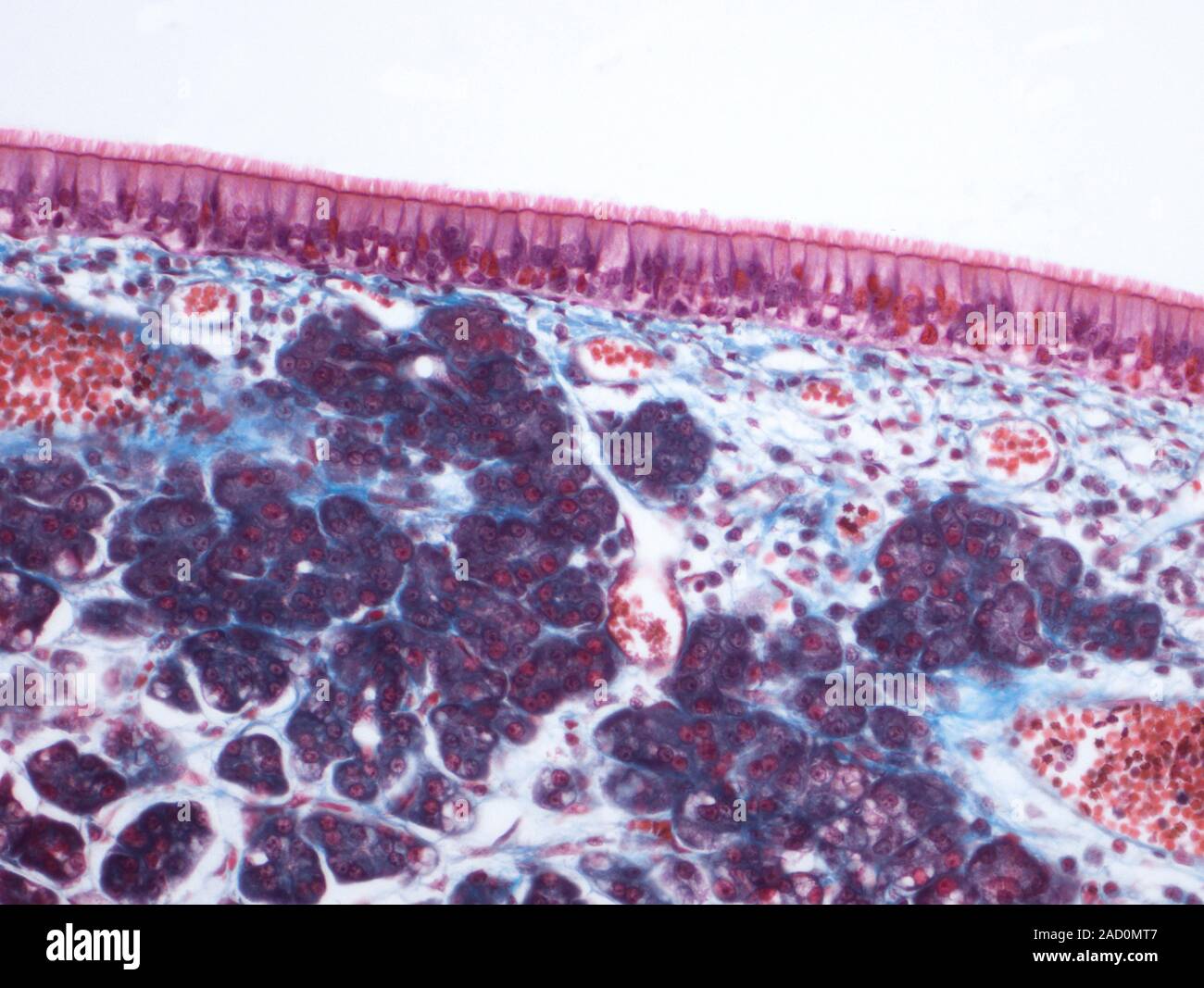 Nasal mucosa. Light micrograph of a section through the nasal mucosa ...