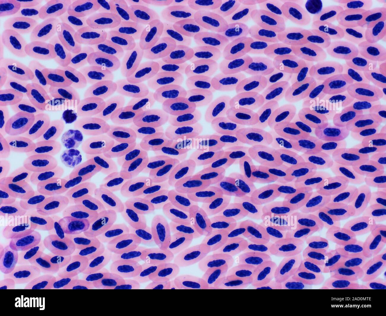 Bird blood, light micrograph. Unlike mammalian erythrocytes (red blood ...