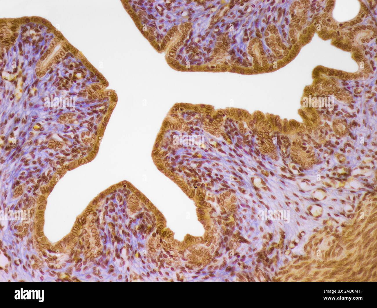 Uterus. Light micrograph of a section through the wall of the uterus ...