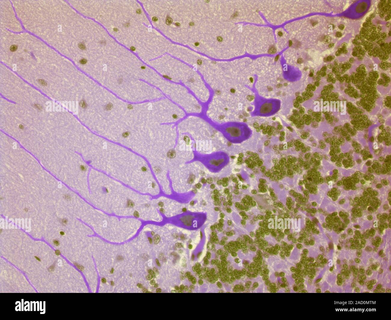 Purkinje nerve cells. Light micrograph of a row of Purkinje nerve cells ...