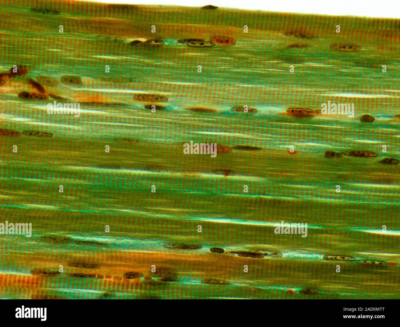Skeletal muscle. Light micrograph of a longitudinal section through leg ...