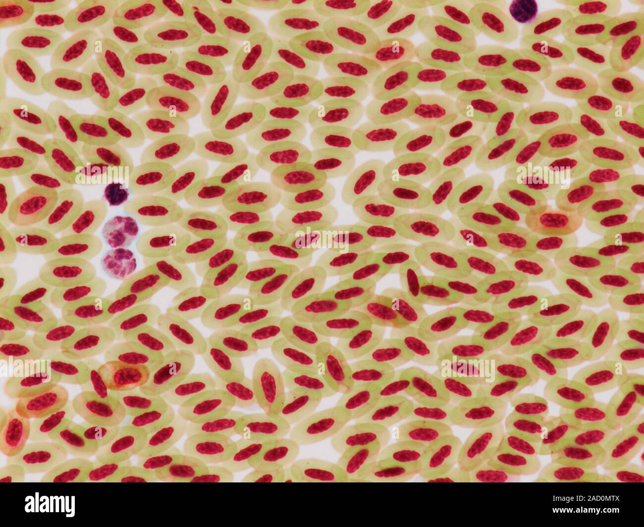 Bird blood, light micrograph. Unlike mammalian erythrocytes (red blood ...