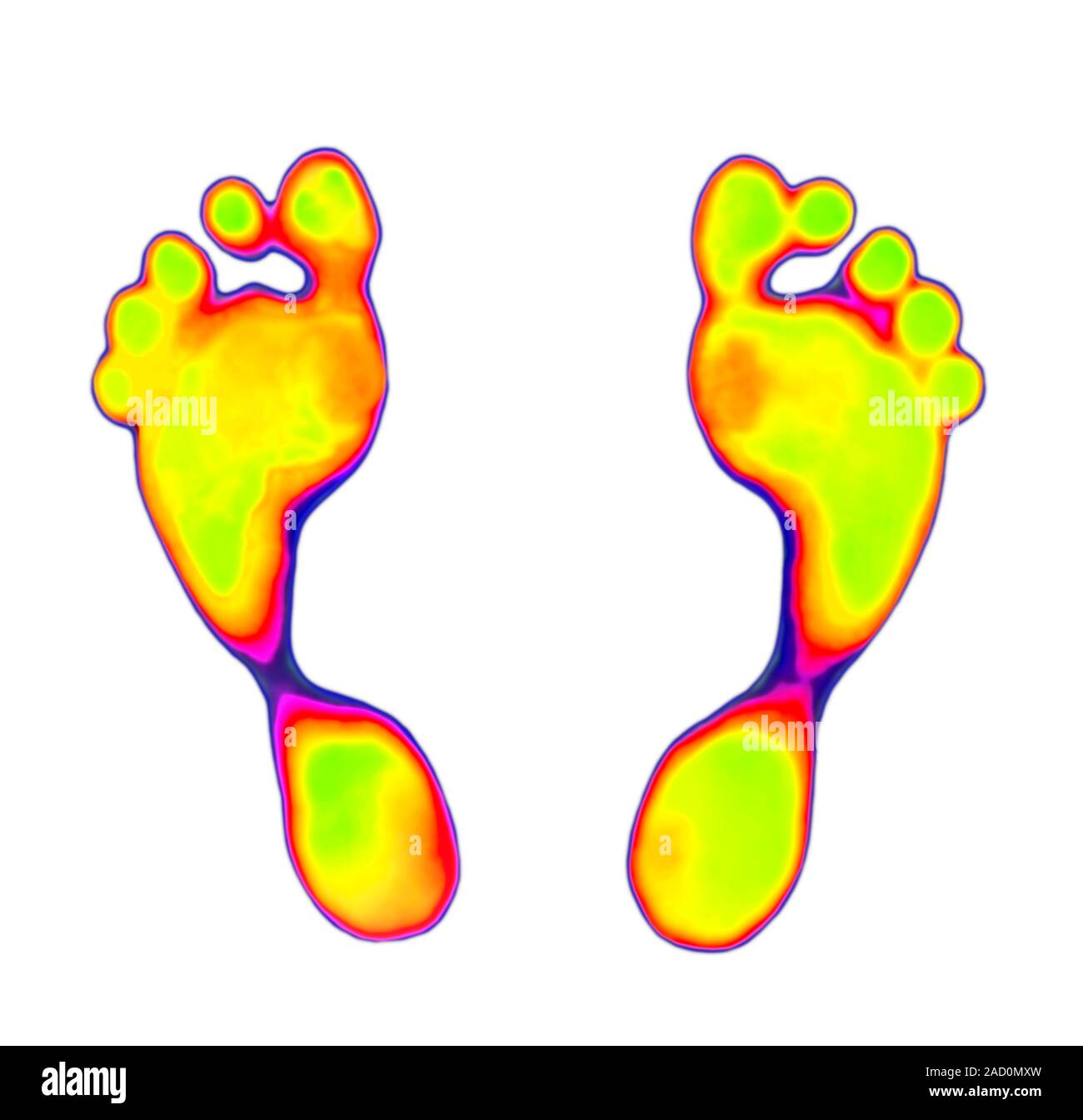 Inverted image of feet produced on thermochromic film. Thermochromic ...