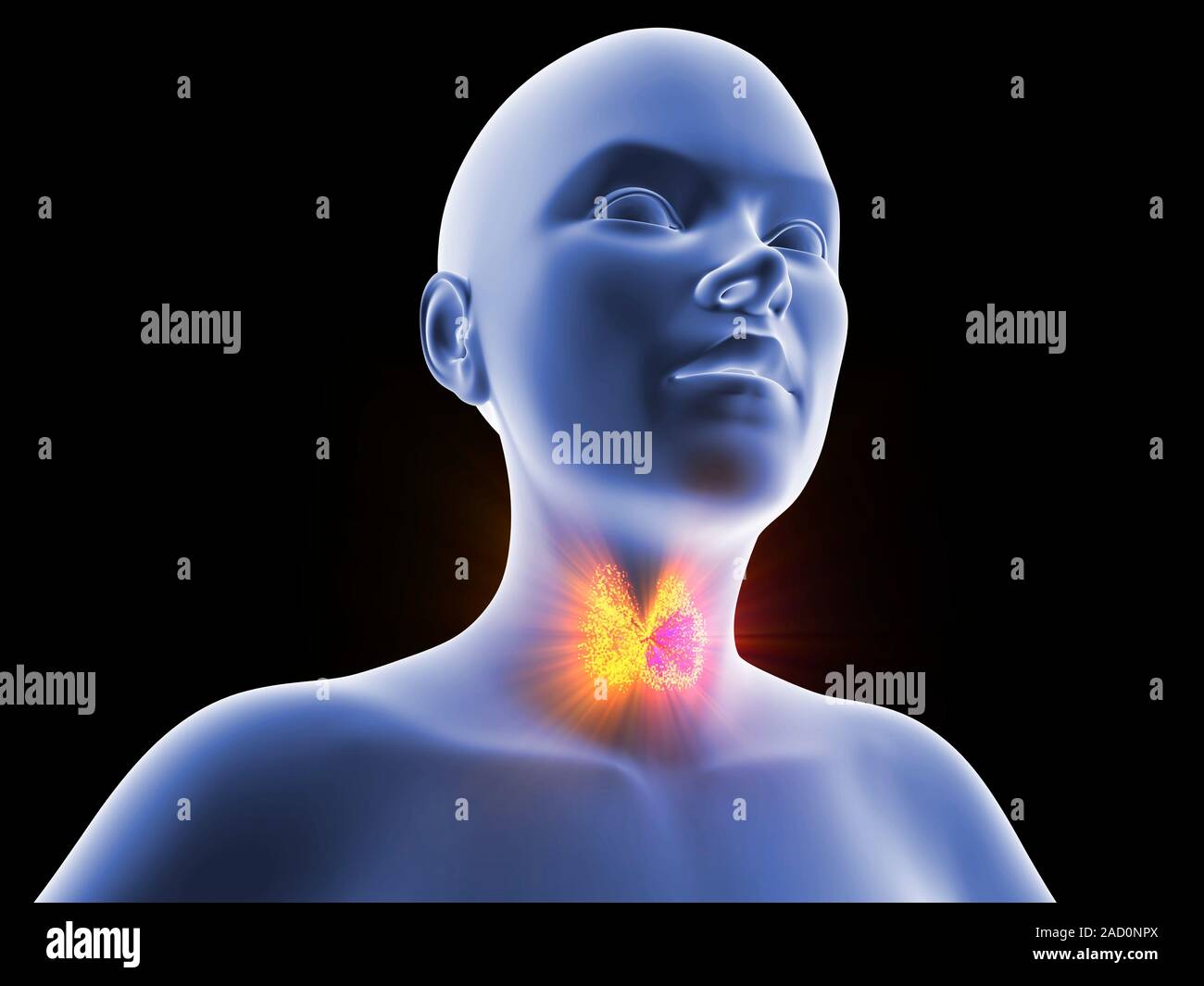 Female head and tyroid gland. Coloured computer-enhanced gamma scan ...