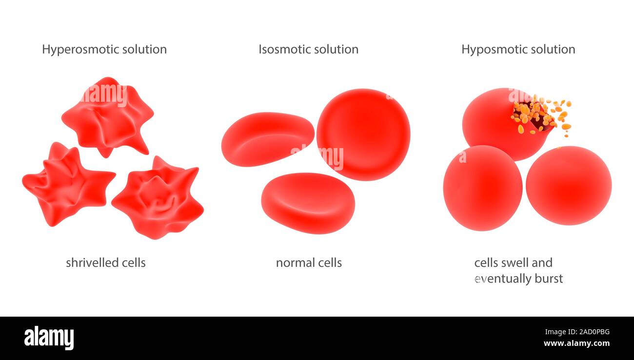 Osmosis in red blood cells. Illustration of the different appearance of ...