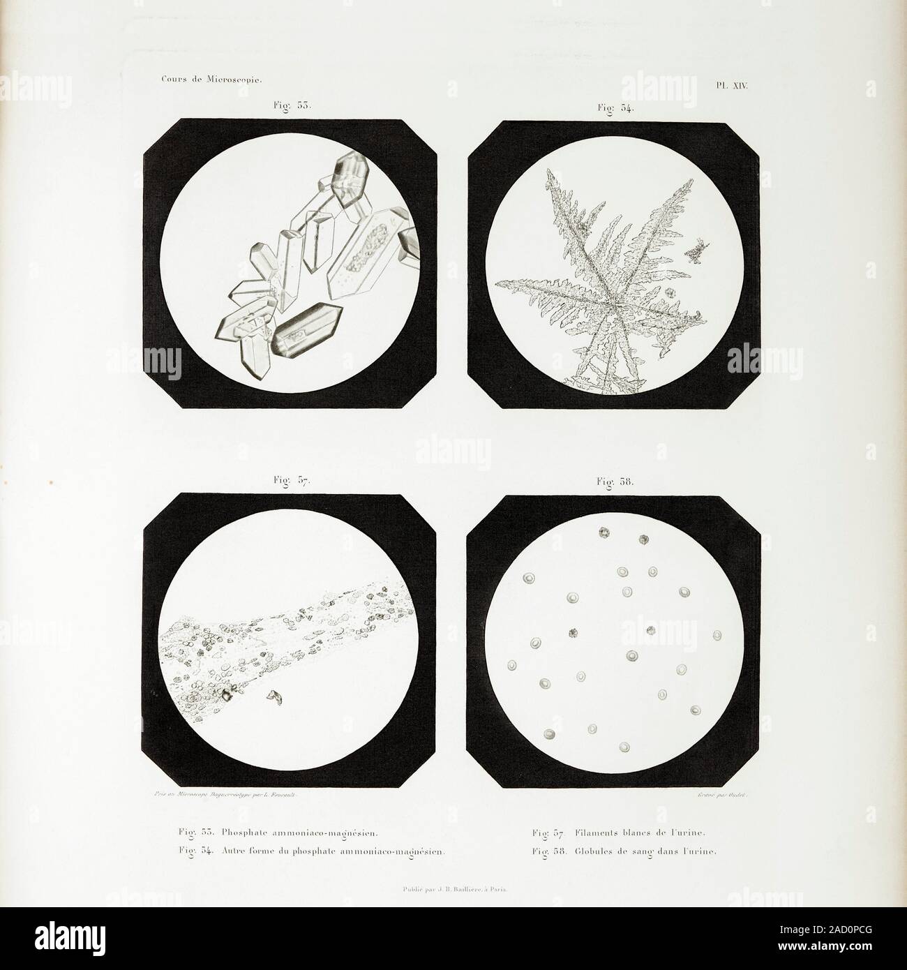 First ever photomicrographs, 1845. This image was published by Alfred ...