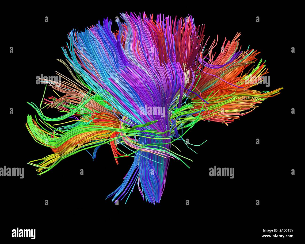 White matter fibres. Coloured 3D diffusion spectral imaging (DSI) scan ...