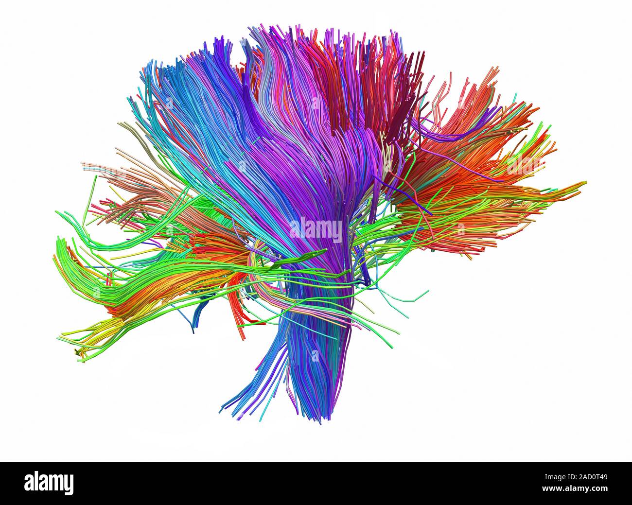 White matter fibres. Coloured 3D diffusion spectral imaging (DSI) scan ...