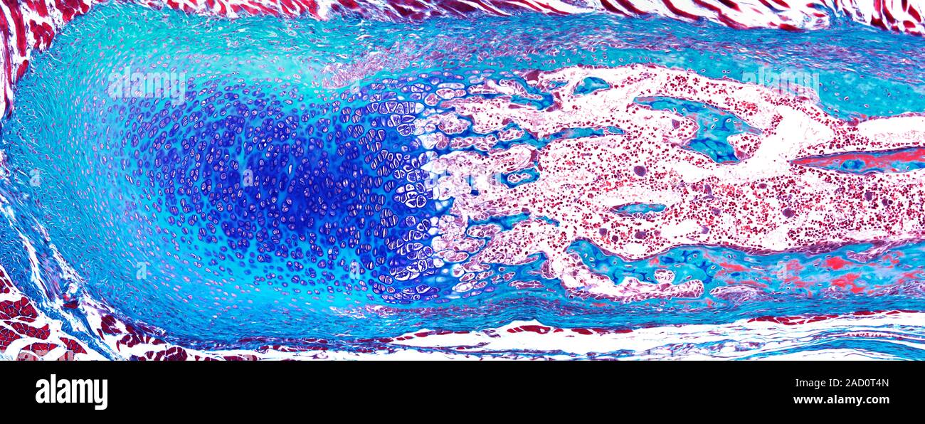 Light microscopy of a growing rib bone. At one end the blue and green ...