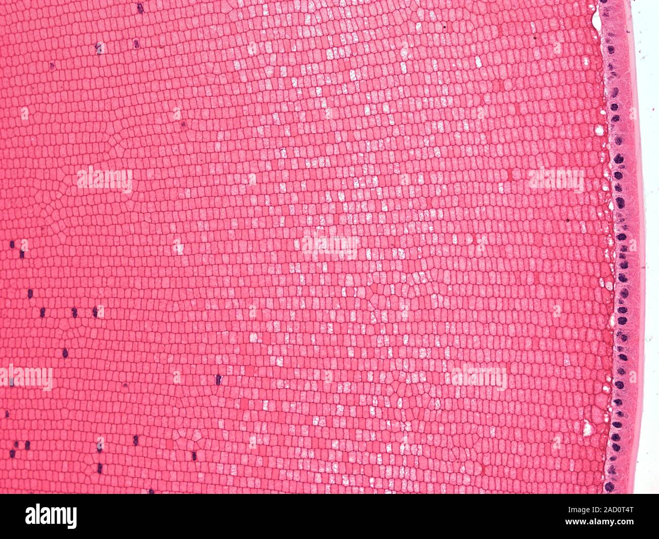 Light microscopy of fibres in the lens of the eye. The lens is covered ...