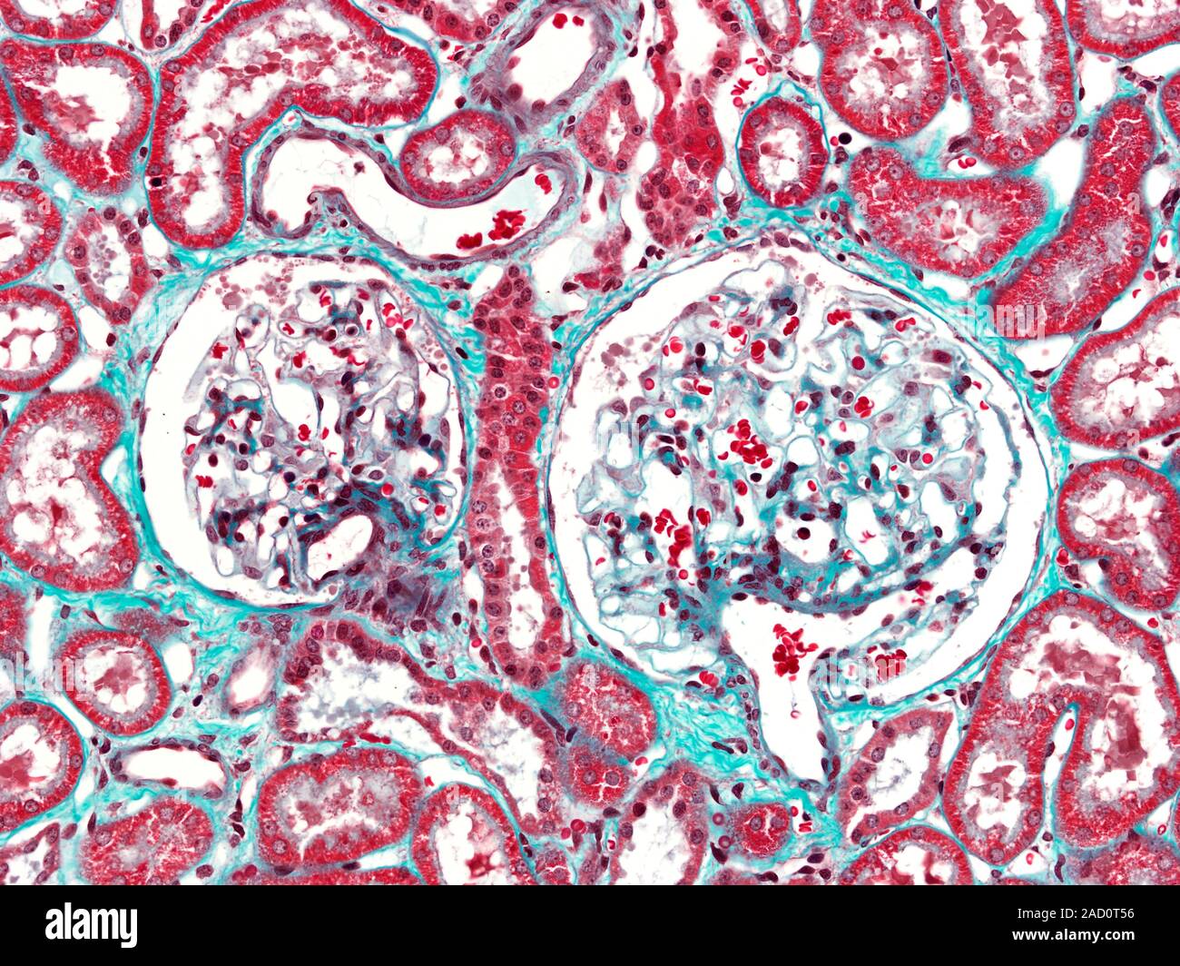 Light microscopy of two renal corpuscles in the kidney. Entering and ...